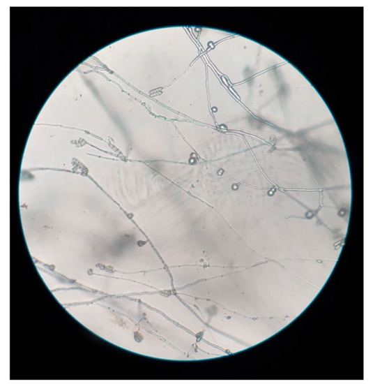 JoF | Special Issue : Clinically Relevant Fusarium Species