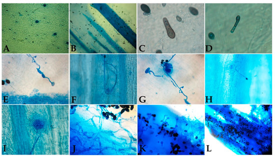 Assessment of Inoculation Methods of Thielaviopsis paradoxa (De Seynes ...