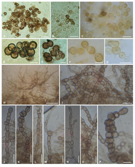 Antarctolichenia onofrii gen. nov. sp. nov. from Antarctic Endolithic ...