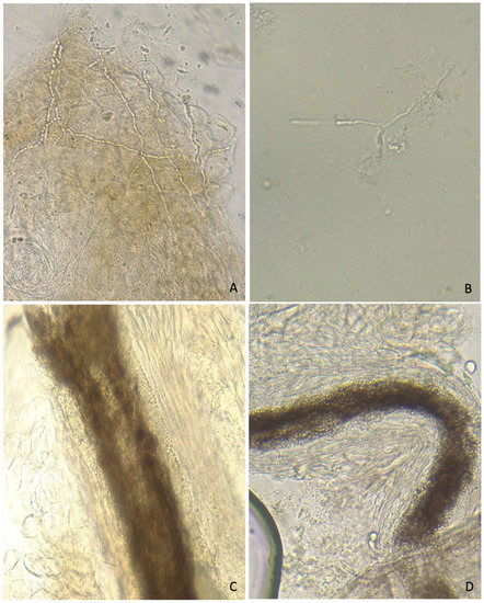 Real-Time PCR Assay for the Detection of Dermatophytes: Comparison ...