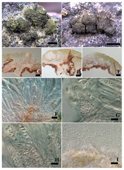 Five New Species of the Lichen-Forming Fungal Genus Peltula from China