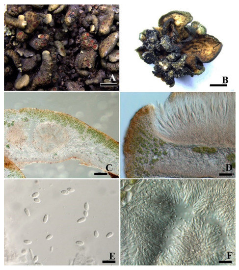 Five New Species of the Lichen-Forming Fungal Genus Peltula from China