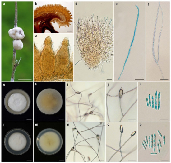 Is Hyperdermium Congeneric with Ascopolyporus? Phylogenetic Relationships of Ascopolyporus spp ...