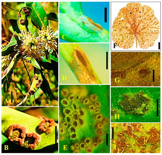 A Global Overview of Diversity and Phylogeny of the Rust Genus Uromyces