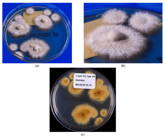 Trichophyton indotineae—An Emerging Pathogen Causing Recalcitrant ...