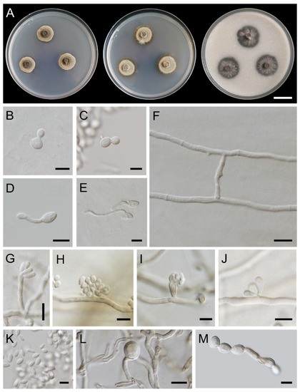 Species Diversity, Distribution, and Phylogeny of Exophiala with the ...