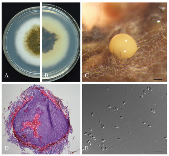 Amplicon Sequencing Reveals Novel Fungal Species Responsible for a ...