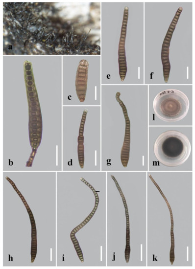 Polyphasic Identification of Distoseptispora with Six New Species from ...