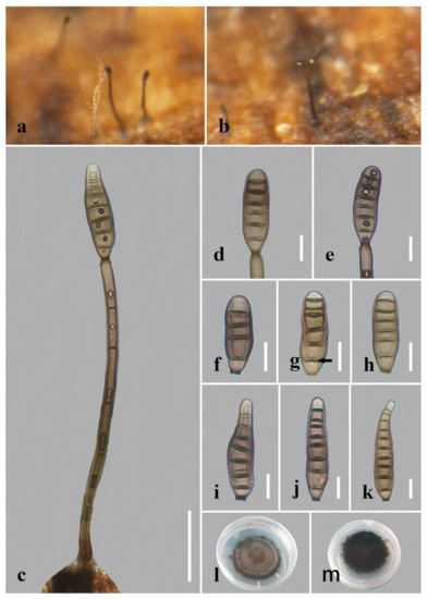 Polyphasic Identification of Distoseptispora with Six New Species from ...