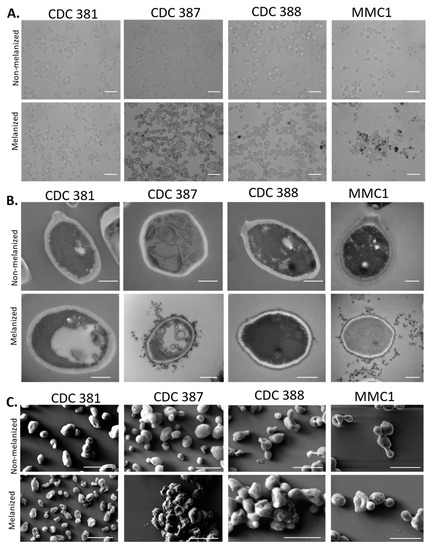 Melanization of Candida auris Is Associated with Alteration of ...