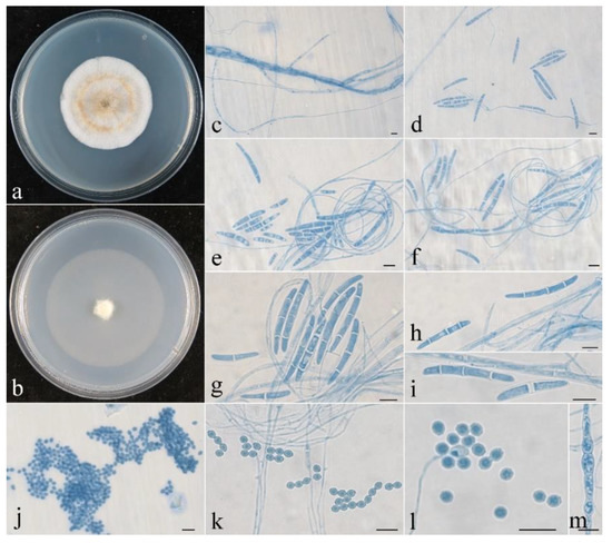 New Species of Nectriaceae (Hypocreales) from China