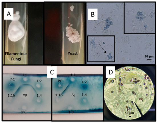 Paracoccidioidomycosis: What We Know and What Is New in Epidemiology ...