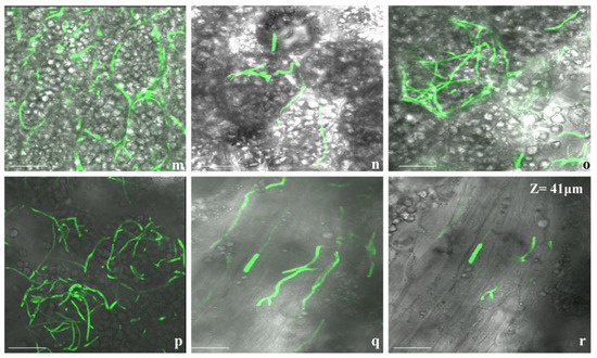 Invasion and Colonization of Pathogenic Fusarium oxysporum R1 in Crocus ...