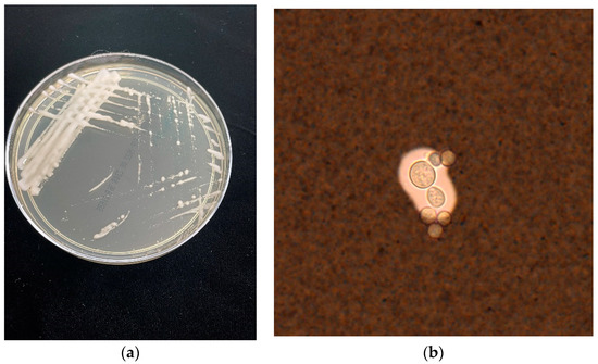 What’s New in Cryptococcus gattii: From Bench to Bedside and Beyond
