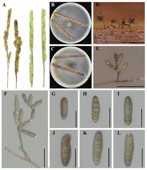 The Chromosome-Scale Genomes of Exserohilum rostratum and Bipolaris ...