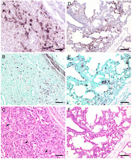 Detection of Pneumocystis and Morphological Description of Fungal ...