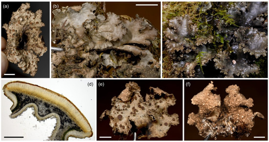 The Lichen Genus Sticta (Lobariaceae, Peltigerales) in East African ...
