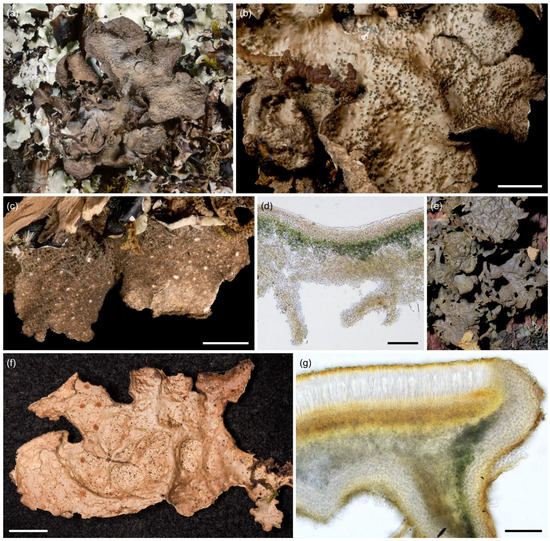 The Lichen Genus Sticta (Lobariaceae, Peltigerales) in East African ...