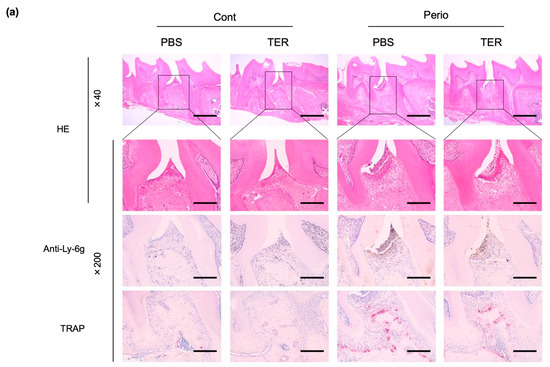 The Fungal Metabolite (+)-Terrein Abrogates Inflammatory Bone ...