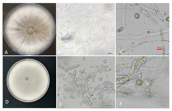 Impact of Fusarium Infection on Potato Quality, Starch Digestibility ...