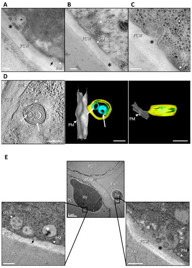 Extracellular Vesicles of the Plant Pathogen Botrytis cinerea