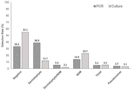 Single-Point Nail Sampling to Diagnose Onychomycosis Caused by Non ...