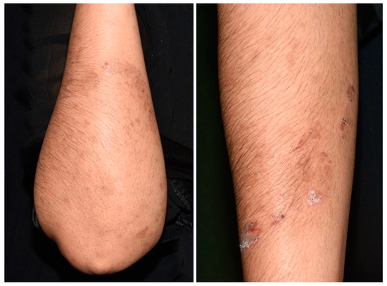 Towards an Early Clinical and Biological Resistance Detection in ...