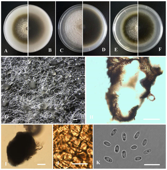 New Species of Didymellaceae within Aquatic Plants from Southwestern China