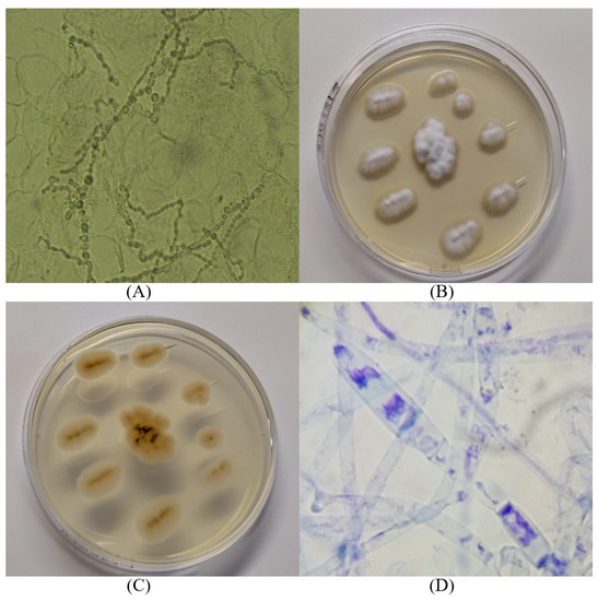 A Terbinafine Sensitive Trichophyton indotineae Strain in Italy: The ...