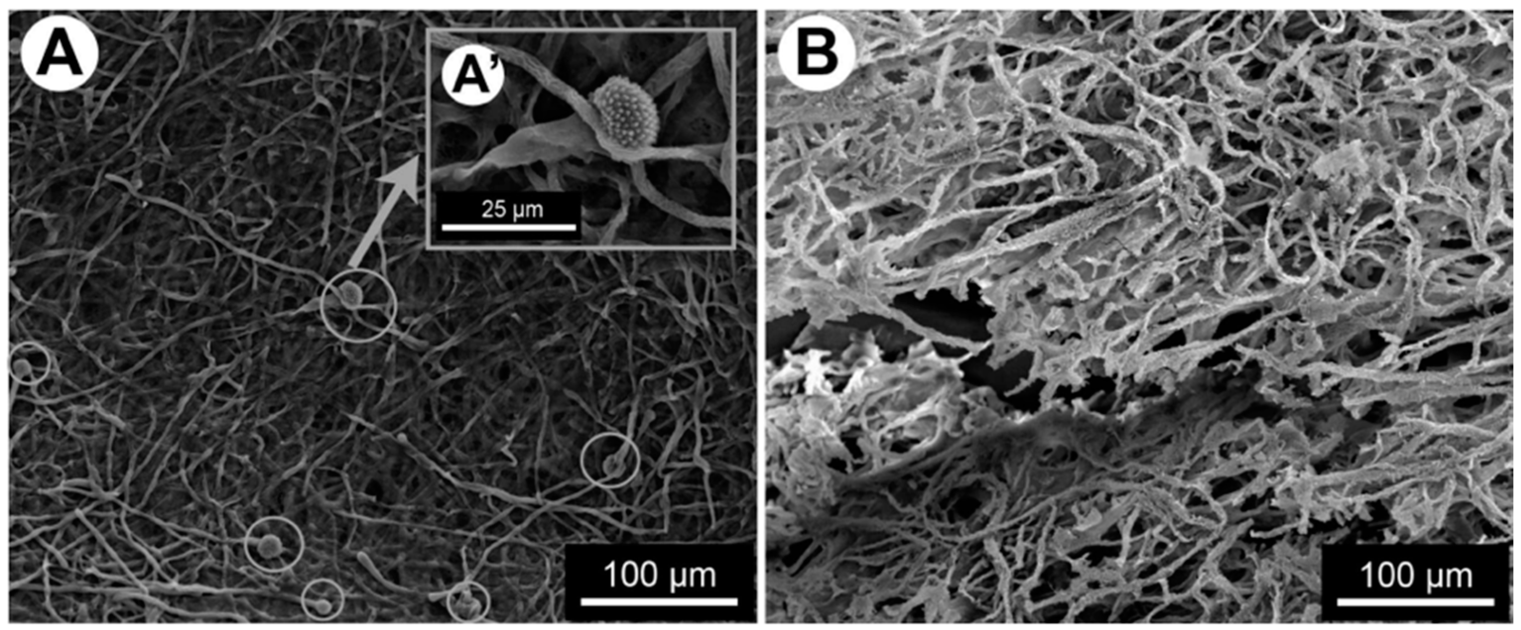 Interactions between Bacteria and Aspergillus fumigatus in Airways ...