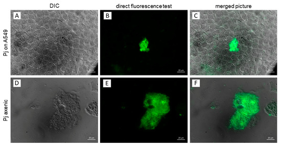 Axenic Long-Term Cultivation of Pneumocystis jirovecii
