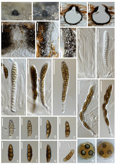 Lignicolous Freshwater Fungi from Plateau Lakes in China (I ...