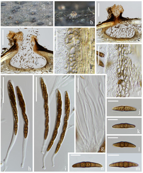 Lignicolous Freshwater Fungi from Plateau Lakes in China (I ...