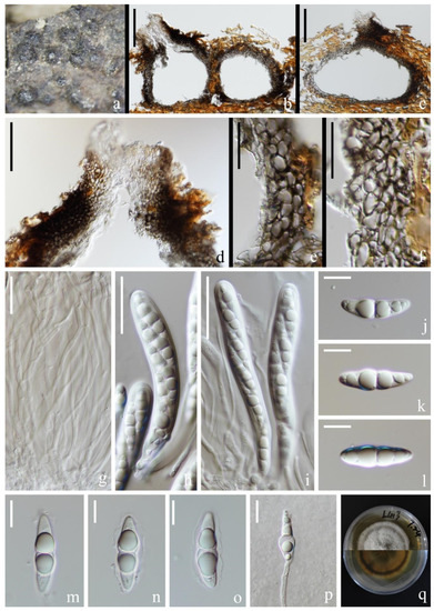 Lignicolous Freshwater Fungi from Plateau Lakes in China (I ...