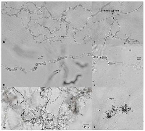 Aphanomyces macrosporus sp. nov. Causing Root Rot in Barley and Some ...