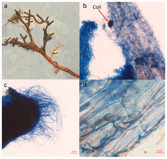 The Diverse Mycorrizal Morphology of Rhododendron dauricum, the Fungal ...