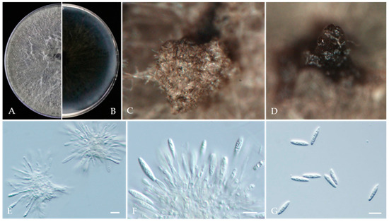 Microfungi Associated with Peach Branch Diseases in China