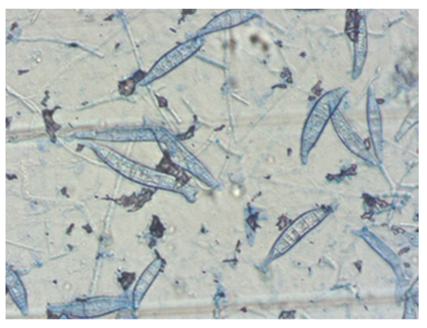 Microsporum Canis In Humans