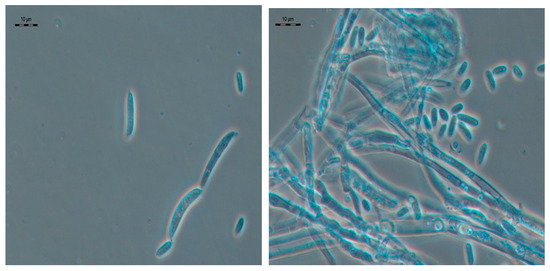 Phytotoxic Strains of Fusarium commune Isolated from Truffles