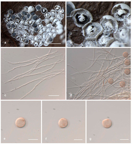 Two New Species of the Genus Diderma (Physarales, Didymiaceae) in China ...
