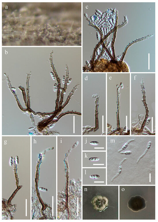 New Species and Records of Pleurotheciaceae from Karst Landscapes in ...