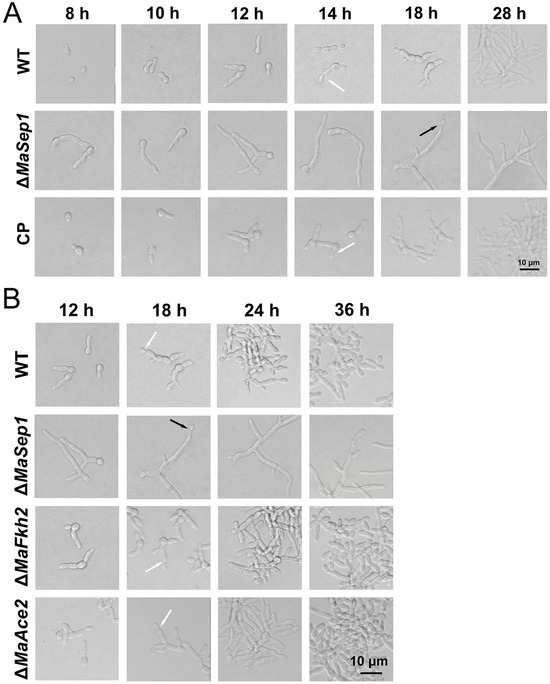 The Forkhead Box Gene, MaSep1, Negatively Regulates UV- and Thermo ...