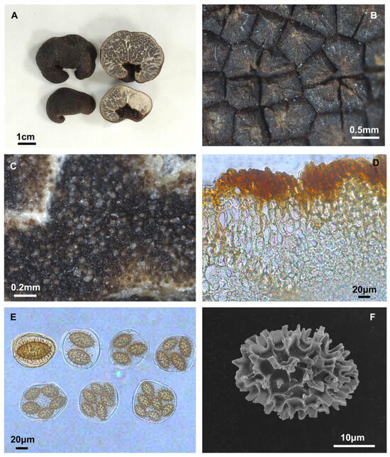 Three New Truffle Species (Tuber, Tuberaceae, Pezizales, and Ascomycota ...