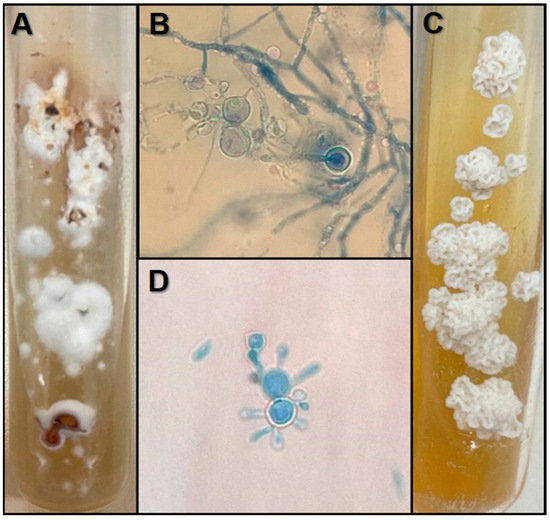 Paracoccidioides Species Circulating in the Endemic Area of Rio de ...
