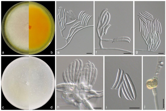 Five New Hypocrealean Species from Algae and Sediment in the Intertidal ...