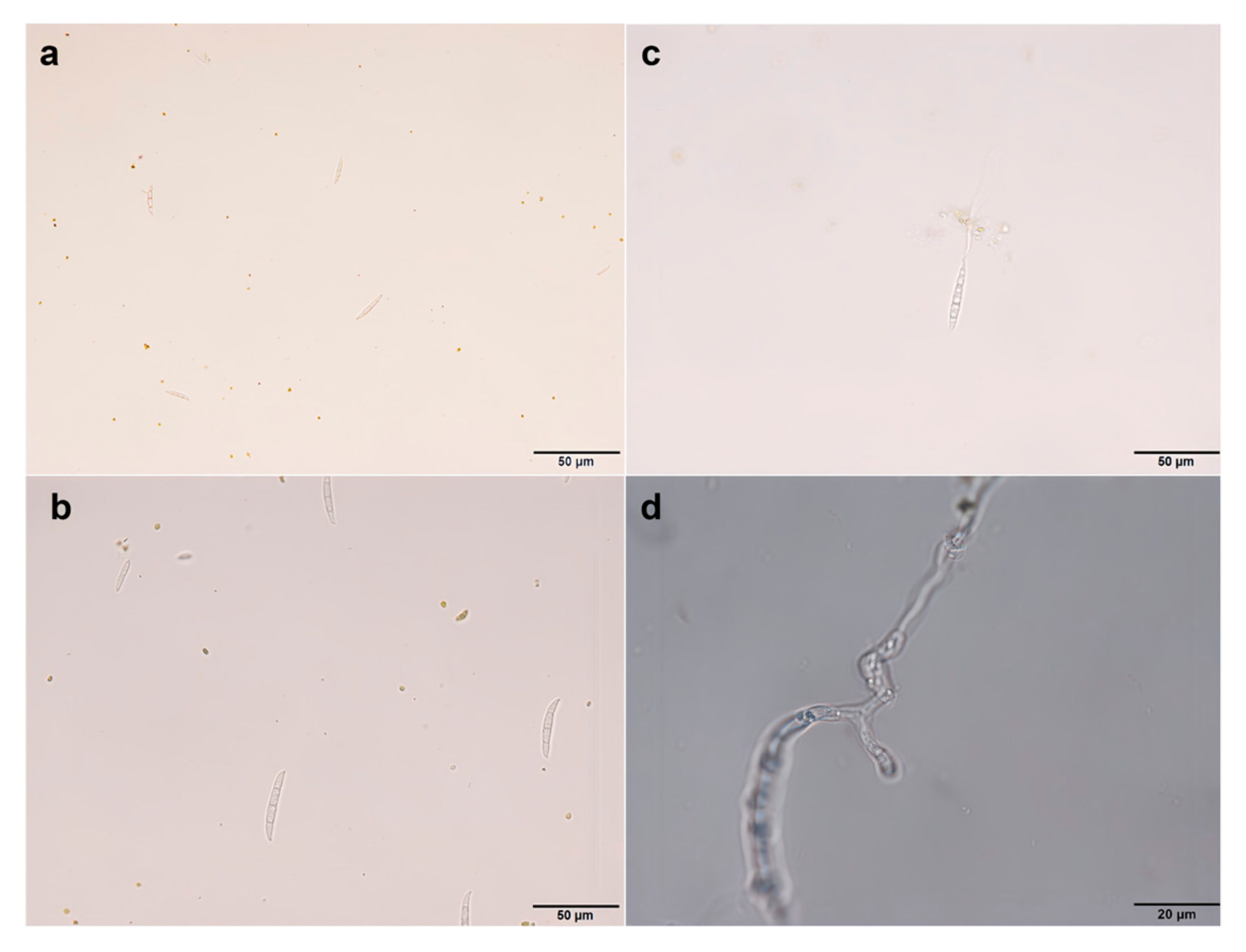 Identifying Key Pathogens and Effective Control Agents for Astragalus ...