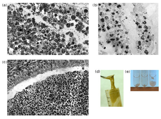 Observations of, and Insights into, Cystic Fibrosis Mucus Heterogeneity ...