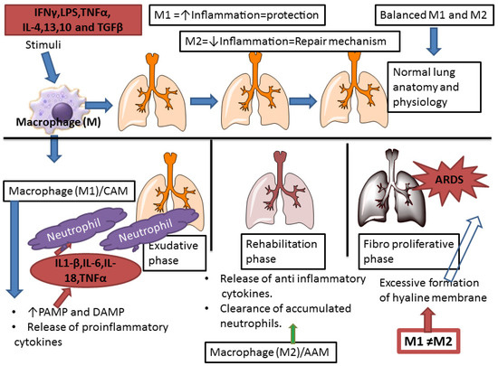Role of Macrophage Polarization in Acute Respiratory Distress Syndrome