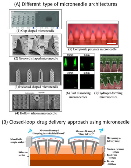 A Perspective on Microneedle-Based Drug Delivery and Diagnostics in ...