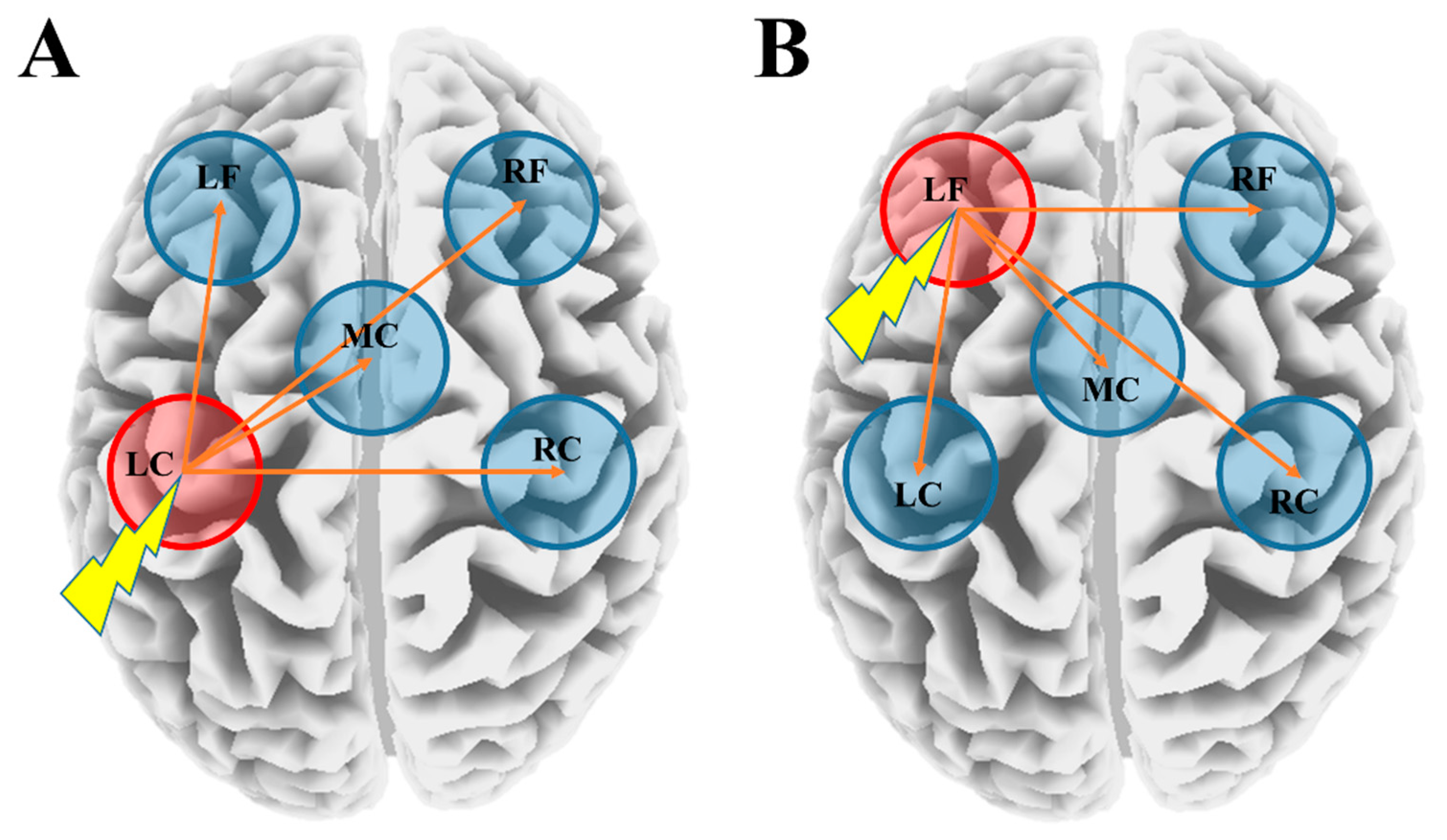 Jpm Free Full Text Single Pulse Transcranial Magnetic Stimulation